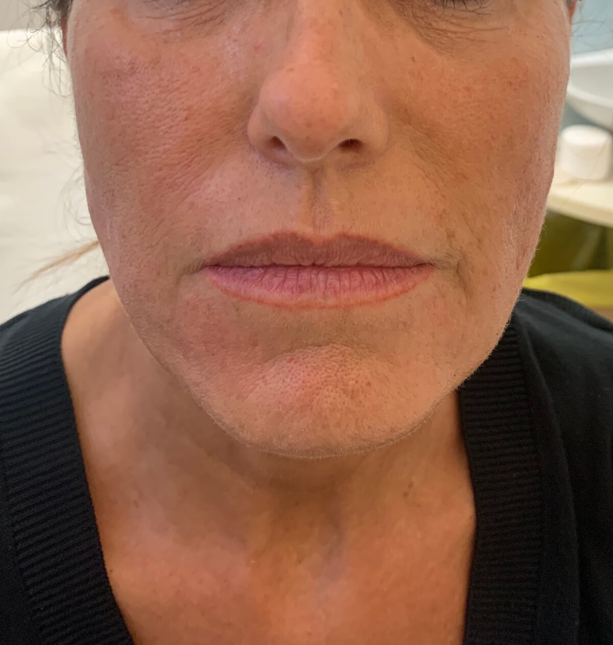 I PEPTIDI, I MIGLIORI ALLEATI DELLA BELLEZZA | Poliambulatorio medico ...